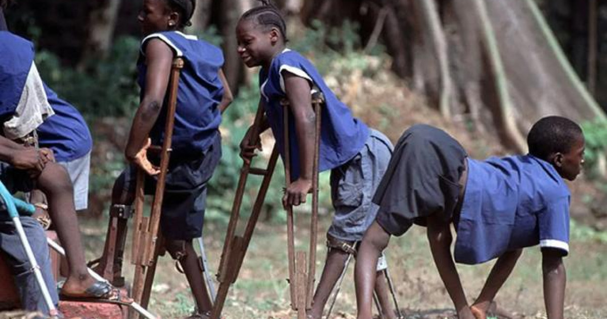 Todo sobre la polio, que parecía erradicada: principales síntomas y causas