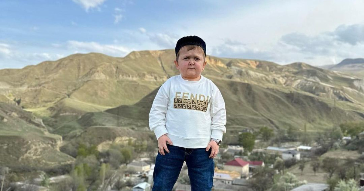 Quién es Hasbulla y cuál es la enfermedad por la que tiene aspecto de niño