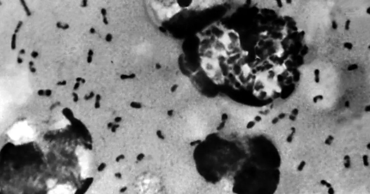 Qué es la peste neumónica que ha matado a una persona en Estados Unidos